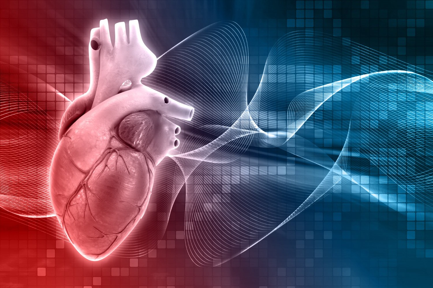 Cardiac Catheterization: Procedures and Purposes - Cardiopedia