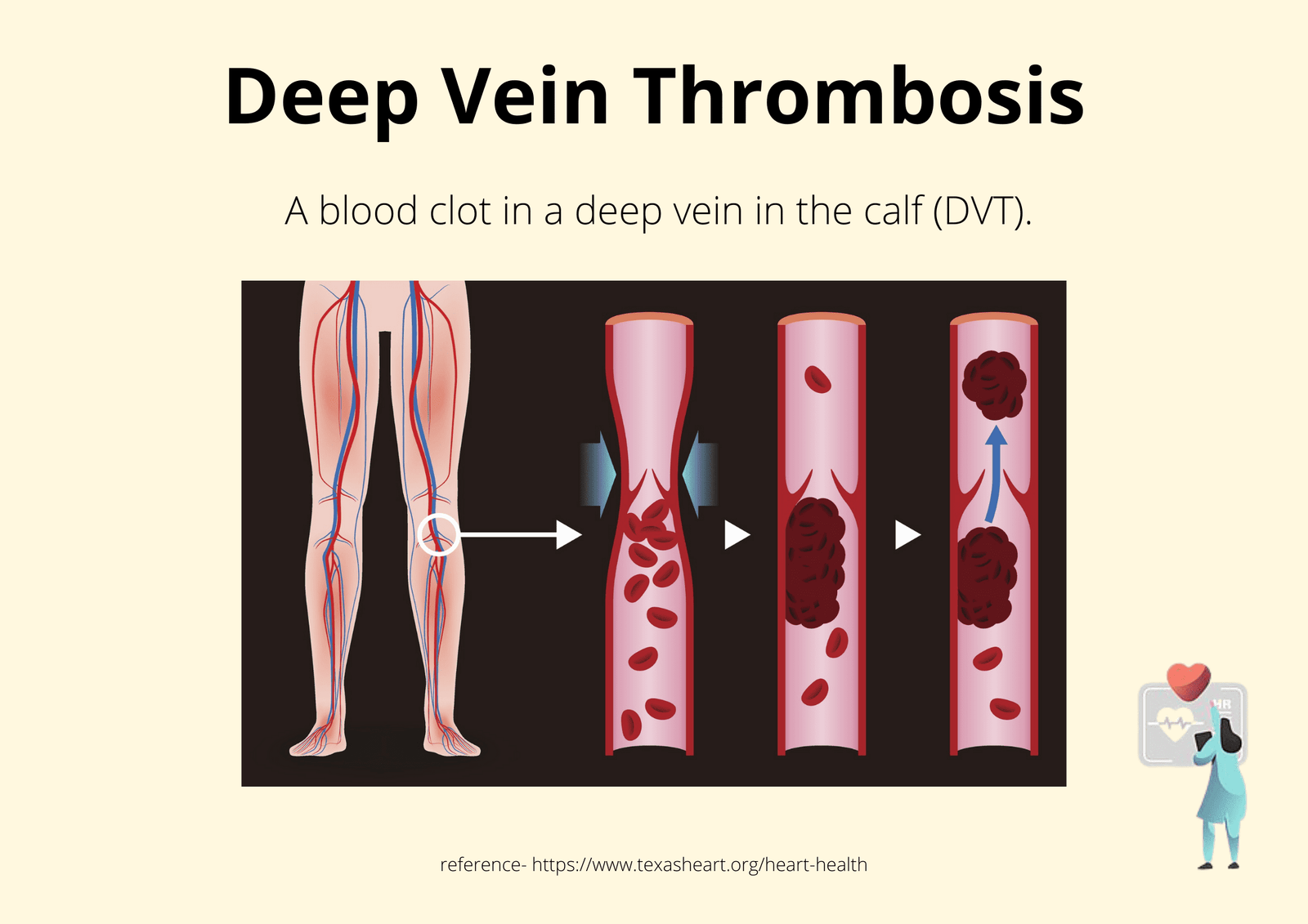 Important Cardiology Terms and Glossary - Cardiopedia